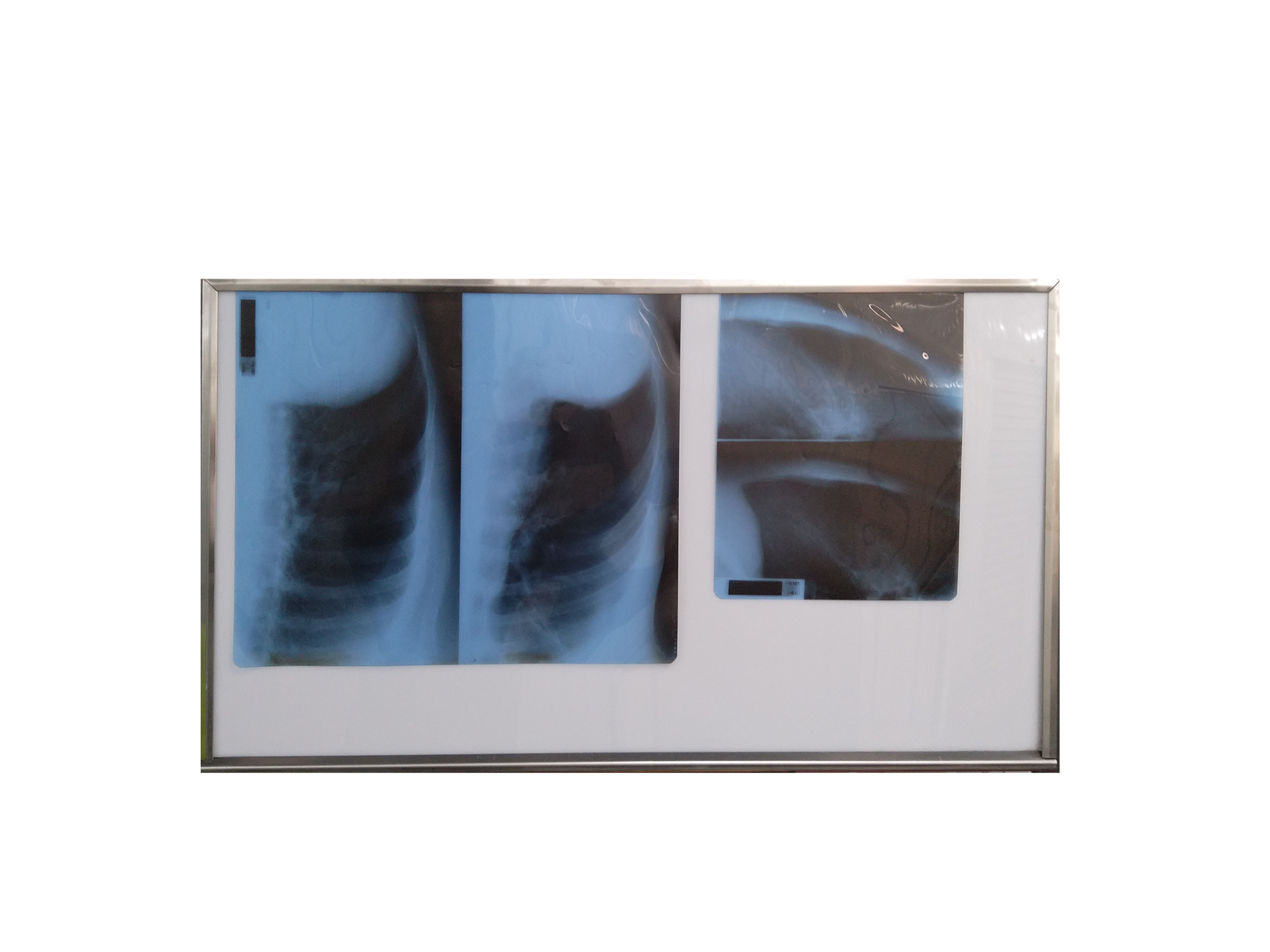 X-RAY light box – Robust84